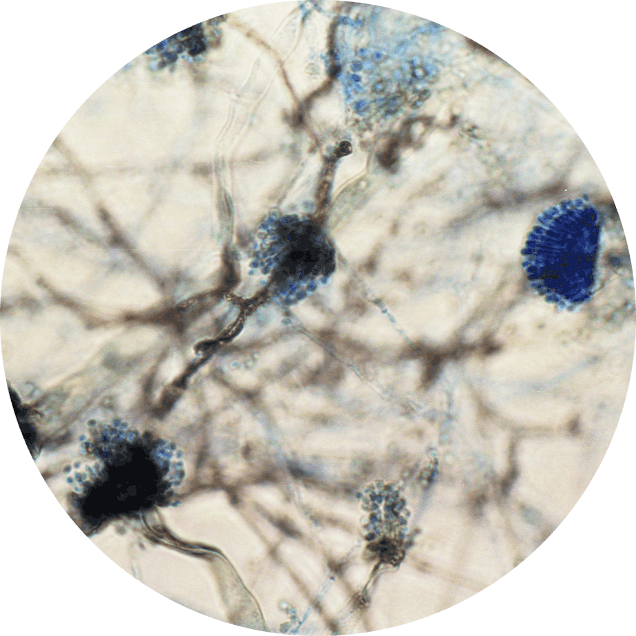 Airborne transmission – ATA Medical